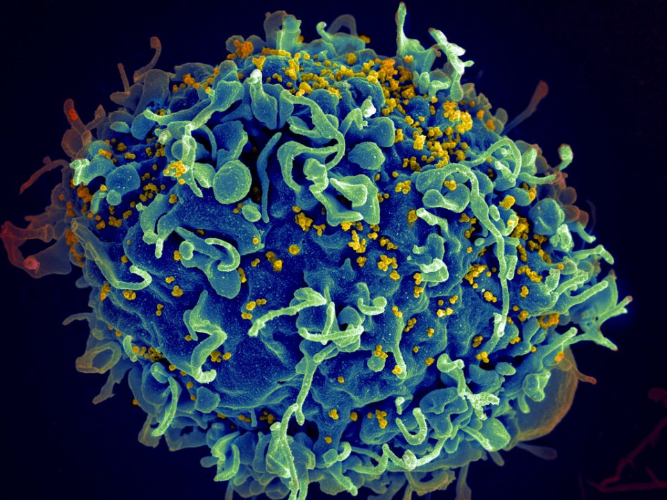 HIV was once a ‘death sentence.’ A Lansing doctor was there from the ...
